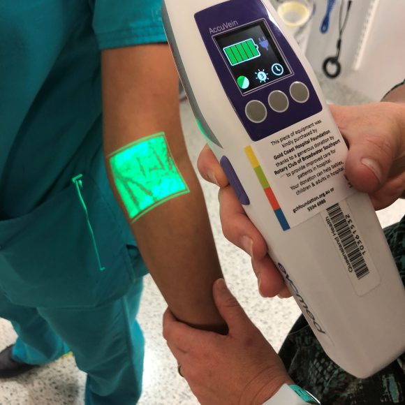 Portable vein finding device reduces stress on young patients - GC ...